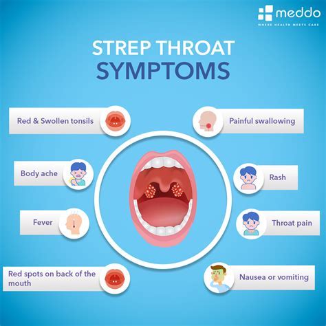 Can Someone Have Strep Throat Without Symptoms