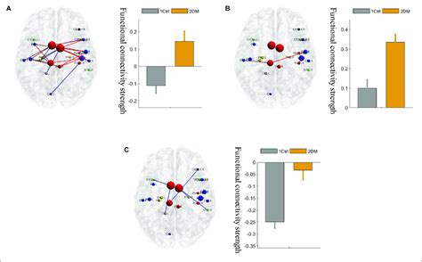Three Different Changed Patterns Of The Functional Connectivities Download Scientific