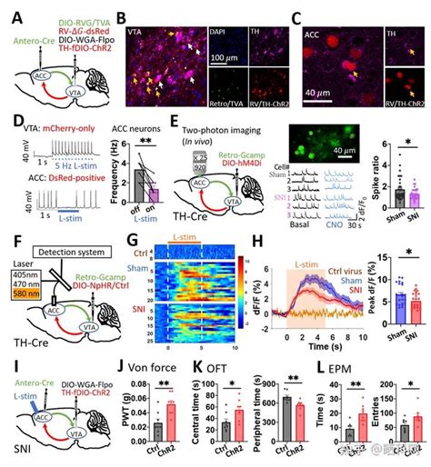 西安交通大学王昌河教授团队揭示痛觉与情绪交互调控及慢性痛长期维持的正反馈神经闭环机制 知乎