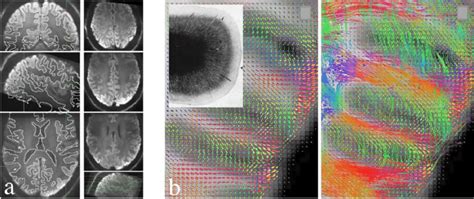 High Resolution 0 8 Mm Isotropic Diffusion Mri Data Acquired Using A Download Scientific