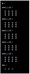 Matlab Zeros Complete Guide To The Matlab Zeros