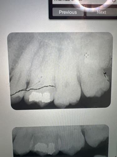 Imaging Errors Flashcards Quizlet