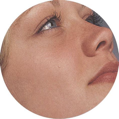 Glogau Wrinkle Scale Dr Richard Glogau Dr Richard Glogau