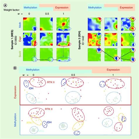 schematic overview of glioma subtypes selected genetic defects and