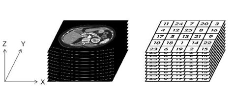 1 A Volumetric Dataset May Be Visualized As A Stack Of Several Hundred