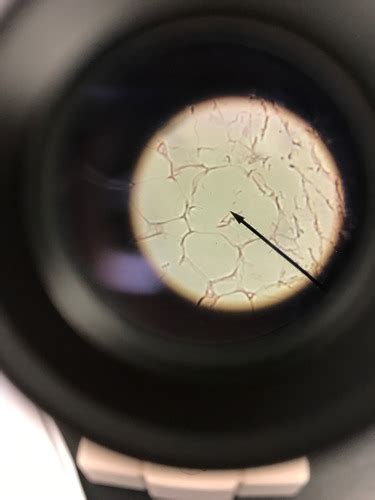 Human Biology Exam 2 Lab Flashcards Quizlet