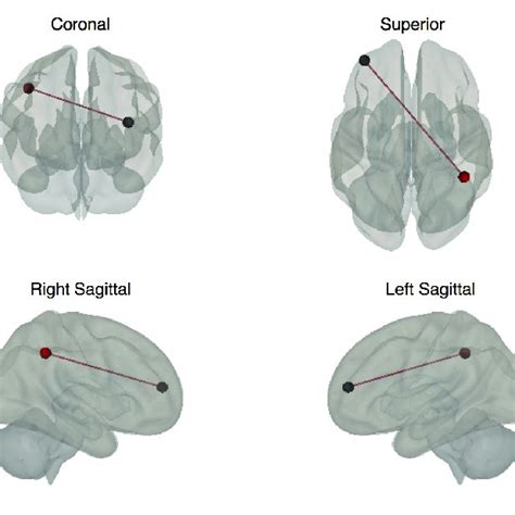 Example Of A 2 Back Working Memory Task Download Scientific Diagram