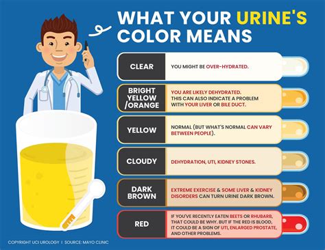 Urology Infographic What Your Urines Color Means Color Of Urine