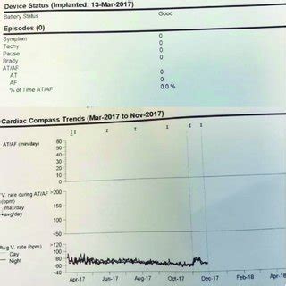 Pacemaker Site Infection Download Scientific Diagram