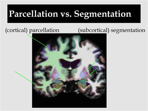 Intro To FreeSurfer Jargon Ppt Download