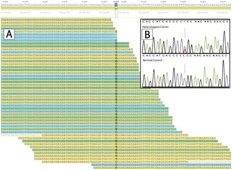 The Alignment And Sanger Sequencing Profiles Of The Tnnt2 R173w Variant Download Scientific