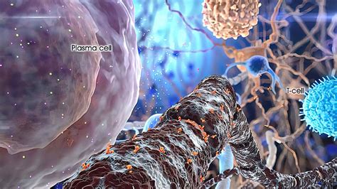 Cancer Composed Of Plasma Cells Transmembrane Concentration Cell Photo