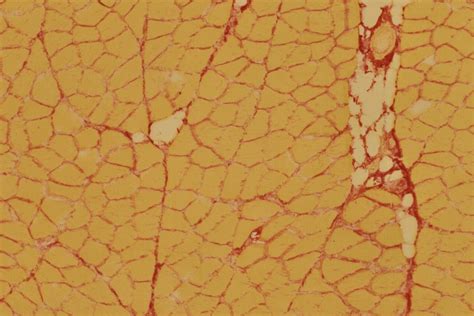 Picture Of The Month Microstructure Of Skeletal Muscle The Key To