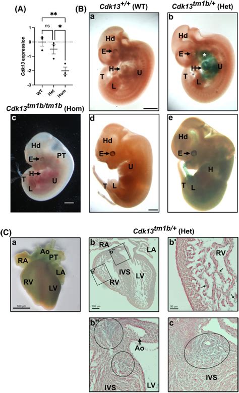 Cyclin‐dependent Kinase 13 Is Indispensable For Normal Mouse Heart