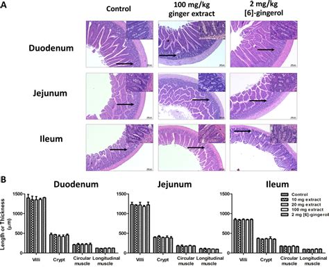 Jejunum Vs Ileum Histologi Chemotherapie Na De Operatie Dikke
