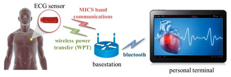 Development Of Ecg Monitoring System And Implantable Device With Wireless Charging