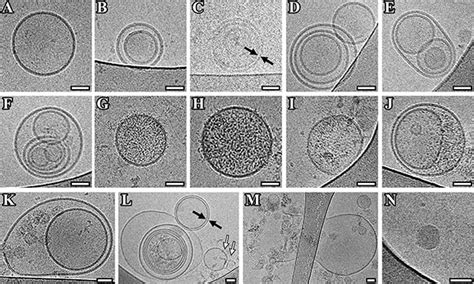 Cryo Electron Microscopy Of Extracellular Vesicles From Cerebrospinal Fluid Exosome Rna