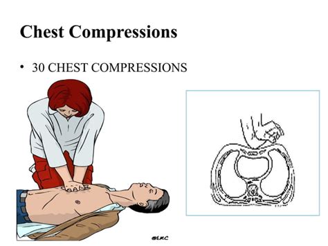 Advanced Cardiac Life Support Acls Shockable Non Shockable Rhythm Pptx