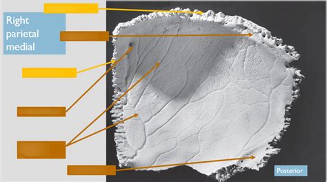 Parietal Medial Diagram Quizlet