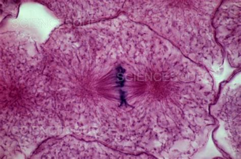 Cell In Late Metaphase Stage Of Mitosi Stock Image Science Source Images