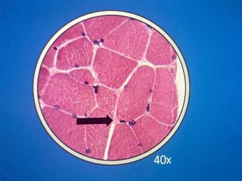 Free The Tip Of The Black Arrow Is Pointing To A A Fibrocyte
