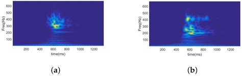 Cnn Transformer For Microseismic Signal Classification