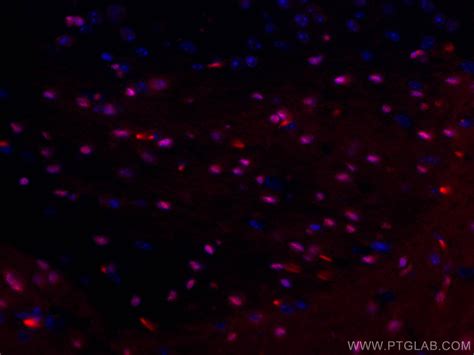 Sox10 Antibody Cl594 66786 Proteintech