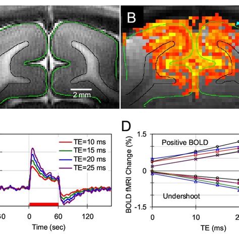 Te Dependence Of Bold Fmri Signals T 1 Weighted Anatomical Image A Download Scientific