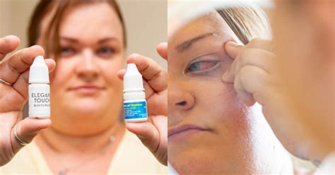 Woman Accidentally Glues Her Eye Shut After Mistaking Nail Glue For Eye Drops