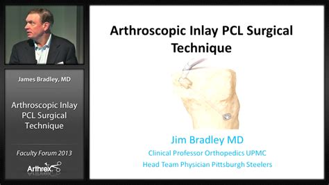 Arthrex Arthroscopic Inlay Pcl Surgical Technique