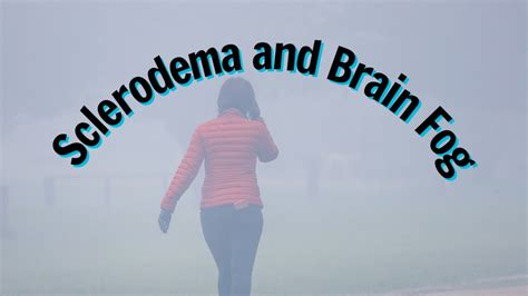 Unveiling Sclerodermas Impact On The Brain What To Know Answer Hubblog