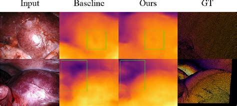 EndoDepthL Lightweight Endoscopic Monocular Depth Estimation With CNN Transformer Paper And