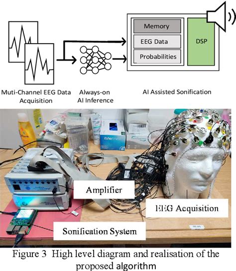 An Implementation Of An Ai Assisted Sonification Algorithm For Neonatal