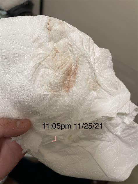 Implantation Bleeding Or Not PIC INCLUDED