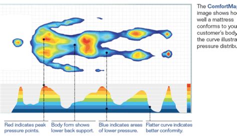Csm Continuous Skin Monitoring