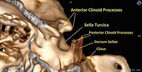Sella Turcica Anatomy
