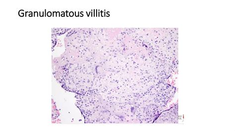 Placenta Pathology Pdf Pregnancy Reproductive Health