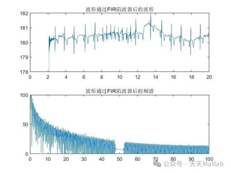 【心电信号】基于fir滤波器和iir滤波器巴特沃思，切比雪夫，椭圆滤波器实现心电信号预处理附matlab代码 fir滤波器和巴特沃斯滤波器