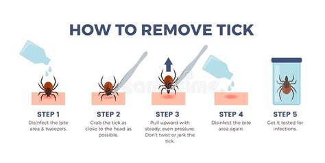 How To Remove Tick Stock Illustrations 27 How To Remove Tick Stock Illustrations Vectors