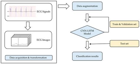 An Automatic Diagnosis Of Arrhythmias Using A Combination Of Cnn And