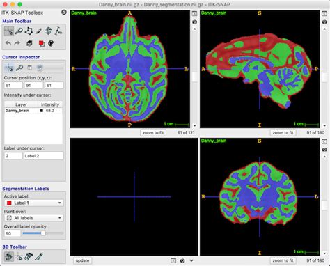 Surfaces And Flatmaps