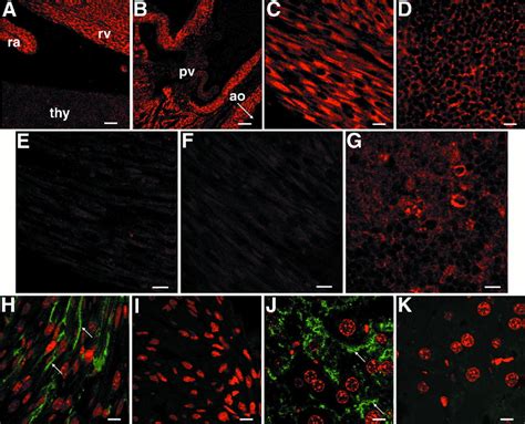 Apoptosis And Proliferation In The Neonatal Murine Heart Fernandez