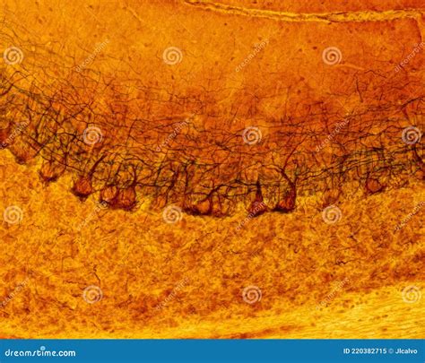 Cerebellum Silver Stain Stock Image 220382659