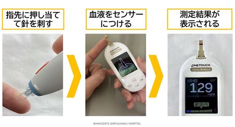 【医療コラム】糖尿病と血糖自己測定（smbg）について｜函館五稜郭病院