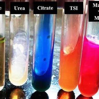 Oxidase Test Showing Oxidase Positive Left Side And Oxidase Negative