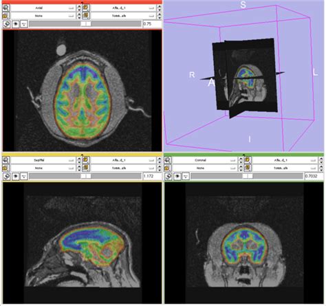 Fsl Based Segmentation Pipeline Namic Wiki