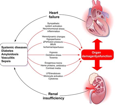 Cardiorenal Syndrome Quest Ce Que Cela Nephroblog