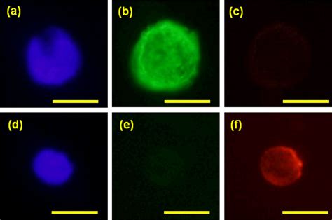 Microchip Based Immunomagnetic Detection Of Circulating Tumor Cells Abstract Europe Pmc