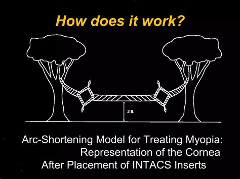 Intacs Corneal Inserts For Treatment Of Keratoconus And Ectasia Ppt