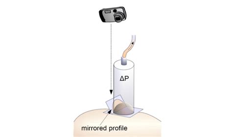 Measurement principle of an aspiration device Δ P aspiration pressure Download Scientific